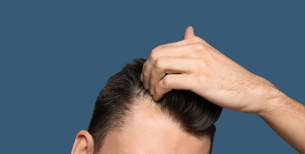 Kopfhaut Pilz: Arten und Behandlungen » meinehaarklinik.de